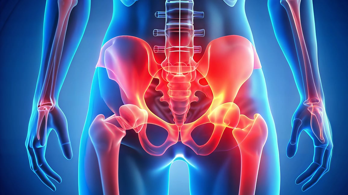 Pelvic Outlet Syndrome Care in Florida | The Institute of Florida